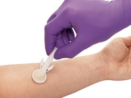 CHLORAPREP® Antiseptic Skin Prep | Life-Assist